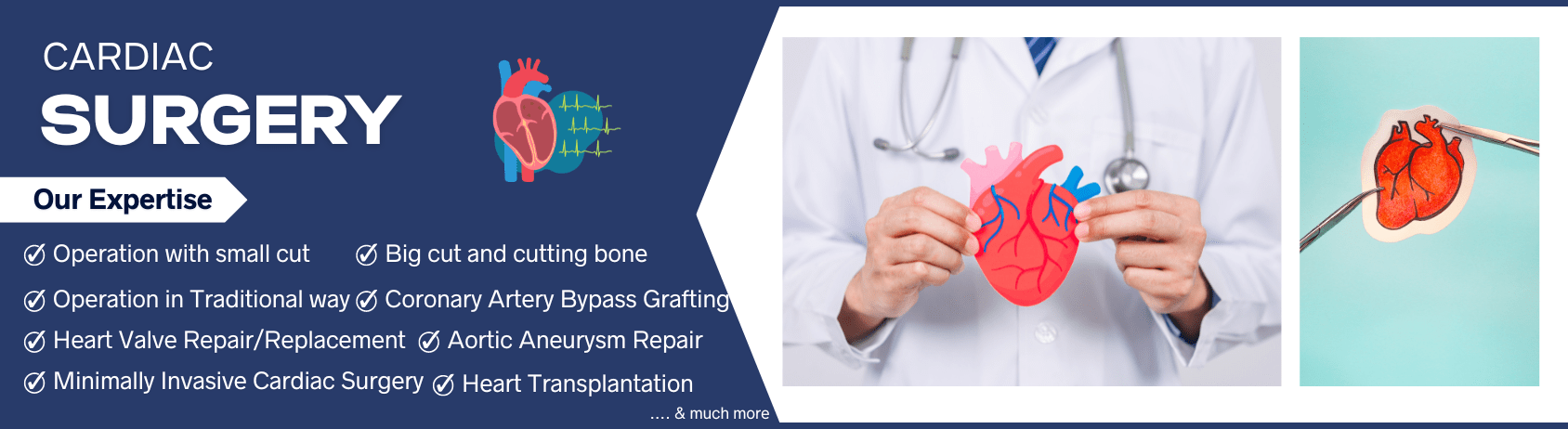 Cardiac Surgery – Cardiac Surgeon Lahore
